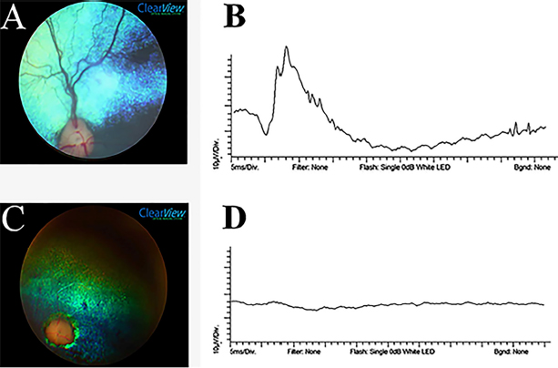 Retrospective and prospective study of progressive retinal atrophy in ...