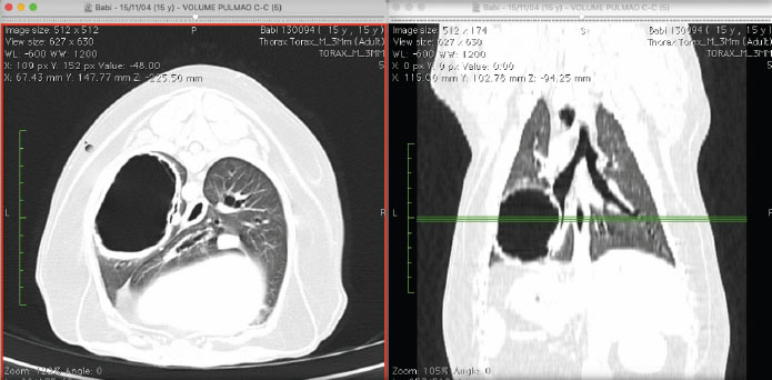 Giant and potentially malignant bullae in a dog | Open Veterinary Journal