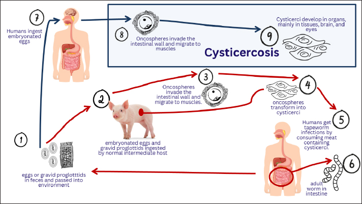 The hidden threat of cysticercosis: A neglected public health problem ...