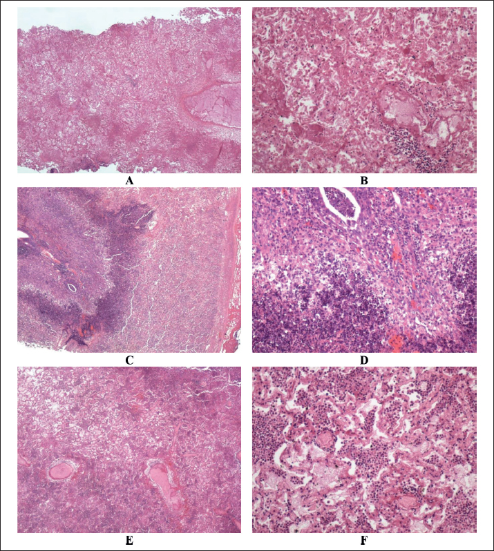 Clinical cases of contagious caprine pleuropneumonia in sheep ...